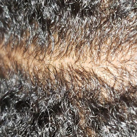 Healthy Scalp Means Healthy Hair – Benu Products